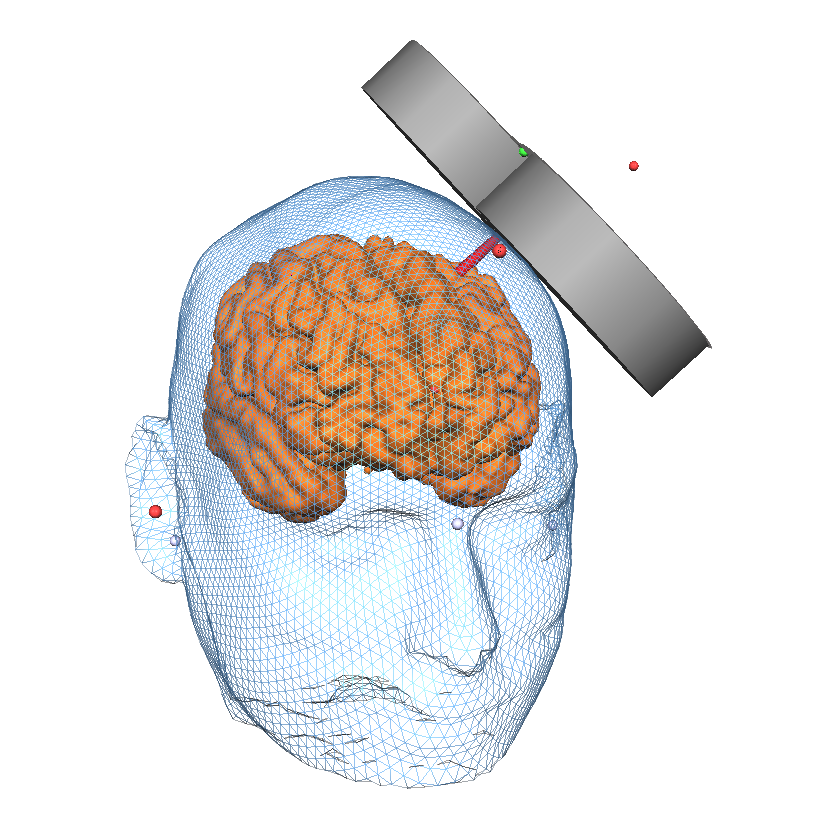 Stroke Rehab – Brain Vision TMS Therapy Centre